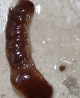 An Array of Organisms Discovered in Stool: Where to Go for Help - All ...